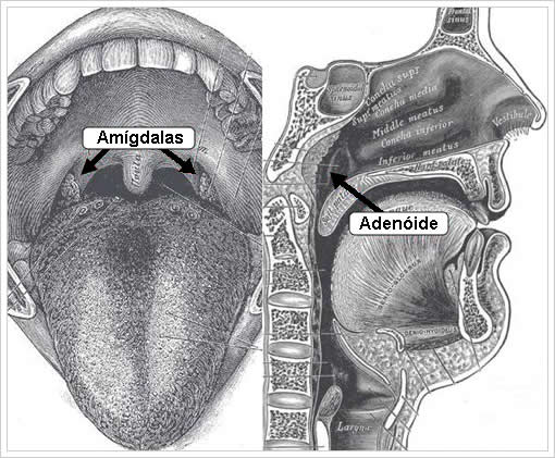 CIRURGIA De AMIGDALAS E Adenoides: Dr. Luciano Moreira